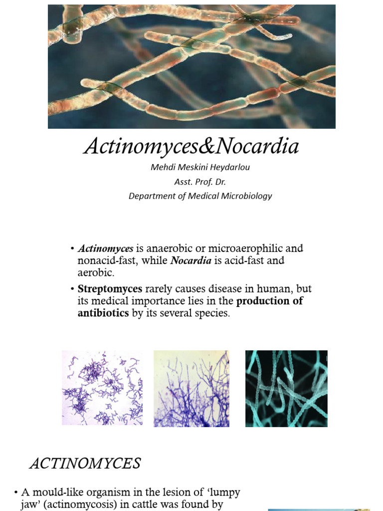 Actinomyces&Nocardia En.2024 | PDF | Bacteria | Infection