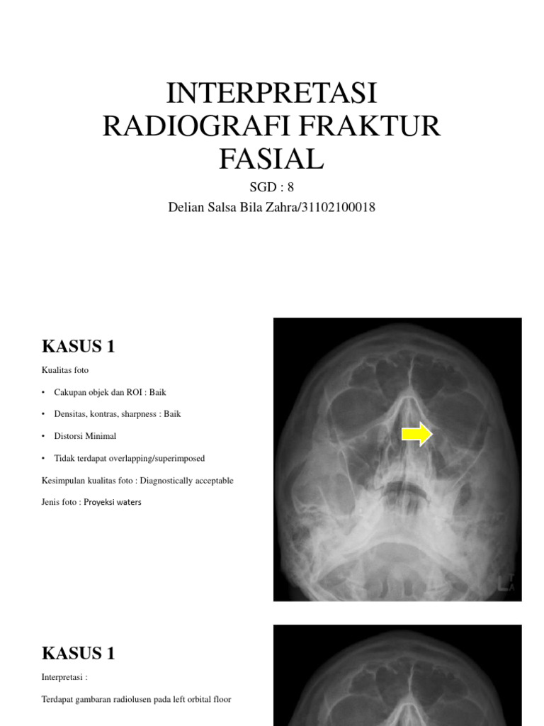 18 Delian Salsa Bila Zahra Skill Lab Interpretasi Fraktur | PDF