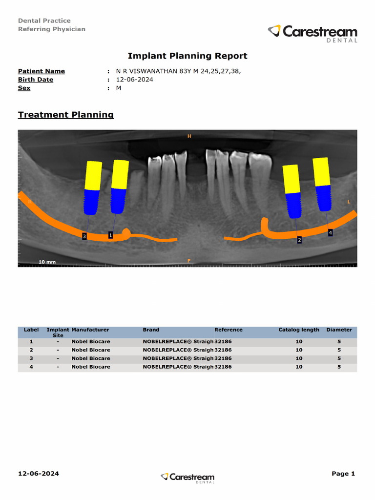 VIrtual Implant PDF | PDF