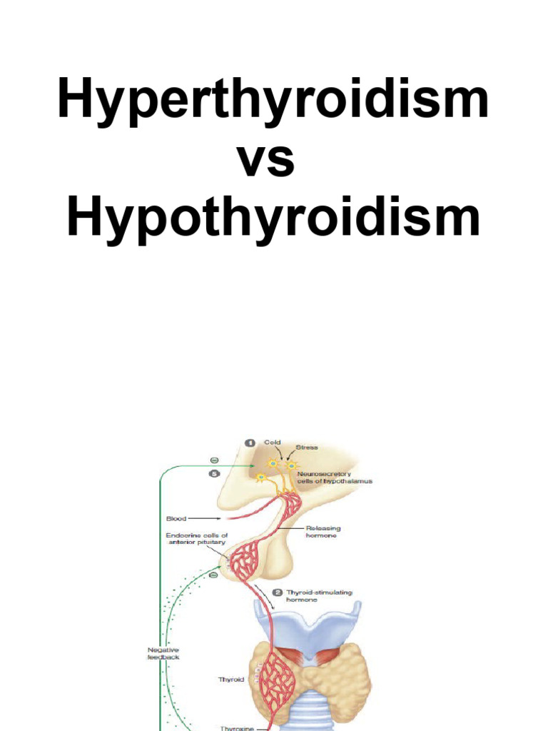 Hyperthyroidism Vs Hyperthyroidism | PDF | Hyperthyroidism | Hypothyroidism