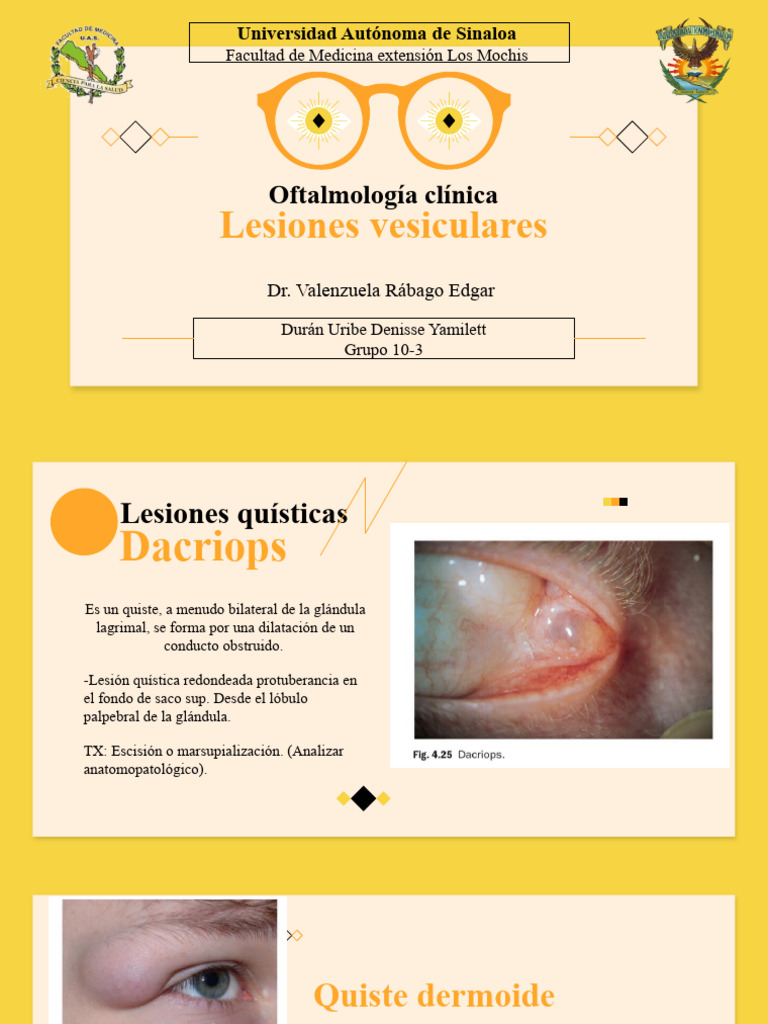 Lesiones irreversibles en Dacriops | PDF | Edema | Neoplasias