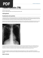 Fisipatologia de La Tuberculosis Pulmonar | PDF | Tuberculosis | Microbiología
