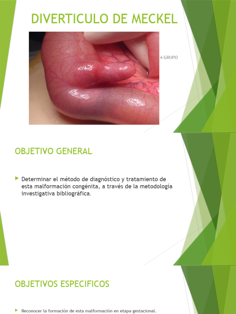 Diverticulo de Meckel | PDF