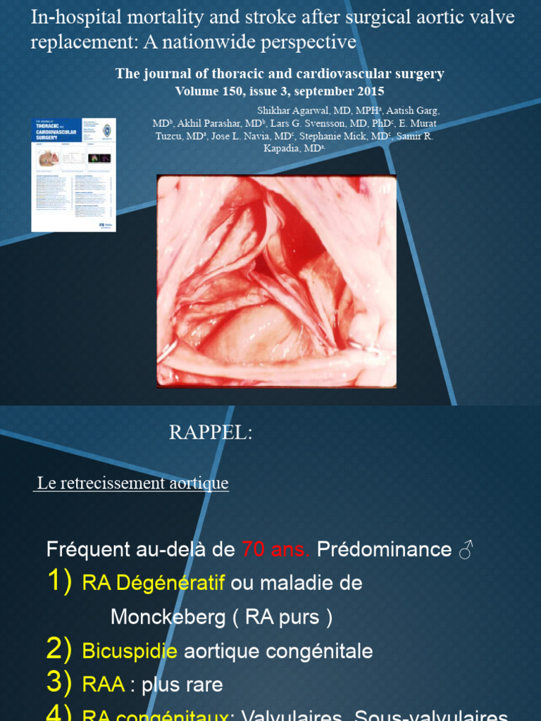 RVA Et AVC 1 | PDF | Épidémiologie | Médecine