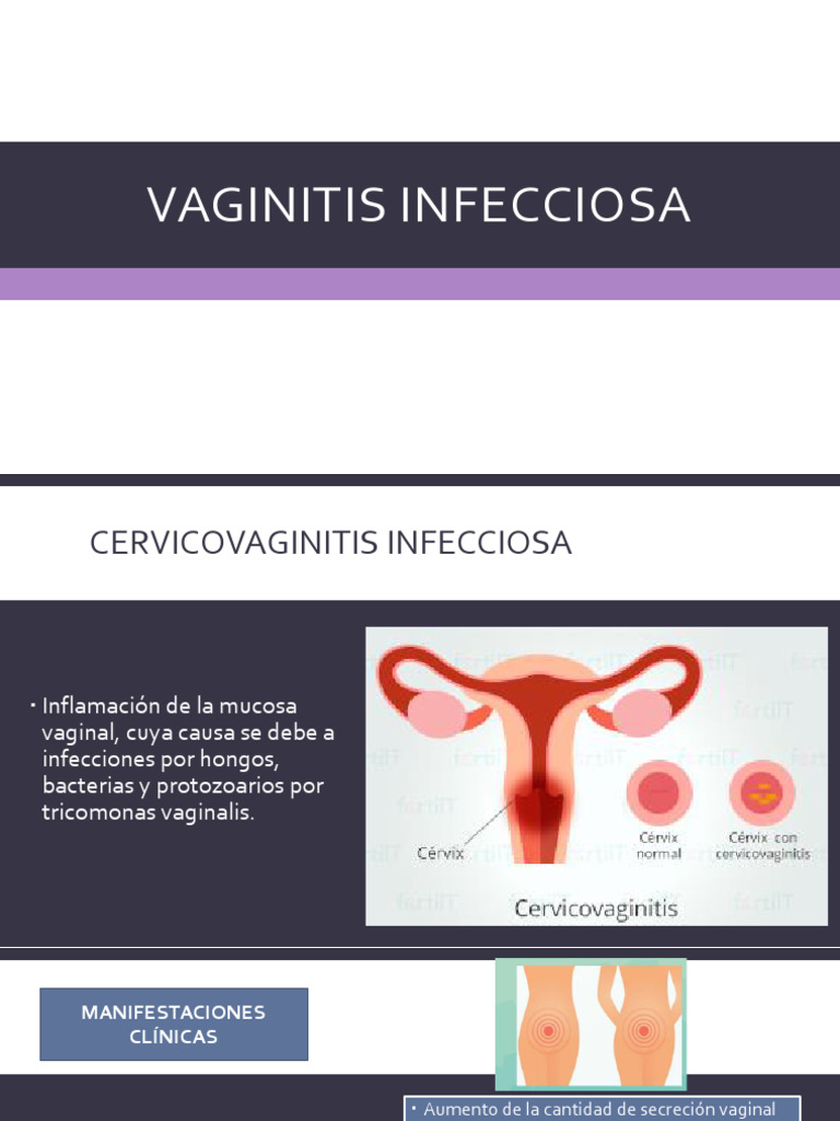 Vaginitis Infecciosa | PDF | Enfermedades y trastornos | Sistema Reproductor Femenino Mamífero