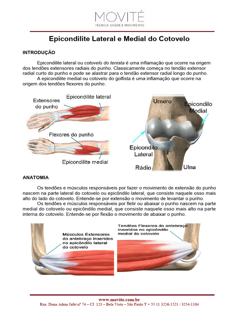 Epicondilite: Causas, Sintomas e Tratamento | PDF | Causas de morte ...