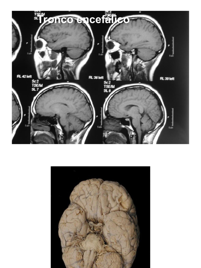 2.clase Tronco Encefálico, Cerebelo | PDF | Anatomía | Anatomía humana