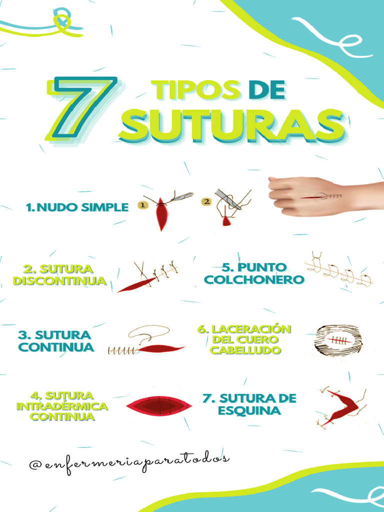 7 TIPOS DE SUTURAS | PDF