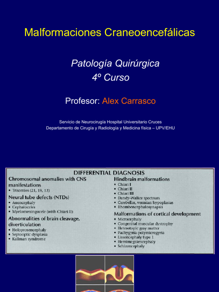 NcC 58 Malform. Craneoencefálicas y Craniosinostosis | PDF | Pediatría ...