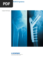 DHS DCS Hip System Surgical Technique (1) | PDF | Hip | Screw