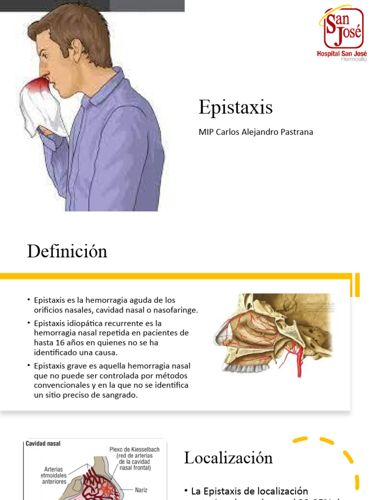 Epistaxis | PDF | Enfermedades y trastornos | Especialidades Medicas