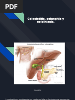 Colelitiasis: Tipos, Síntomas y Tratamiento | PDF | Causas de la muerte | Epidemiología