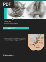 Episiotomy and Its Care | PDF | Surgical Suture | Childbirth