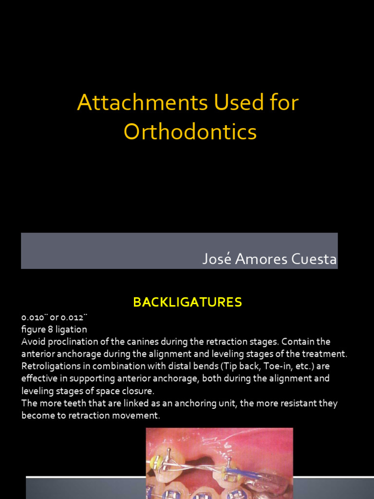 Orthodontic Attachment Techniques Explained | PDF | Orthodontics ...