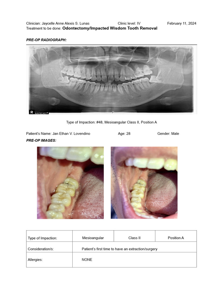 TX Plan Odontectomy Alexis | PDF | Surgery | Clinical Medicine