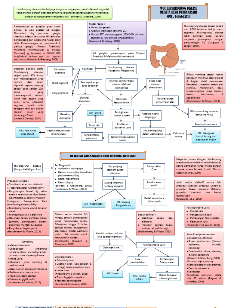 WOC Hirschsprung | PDF