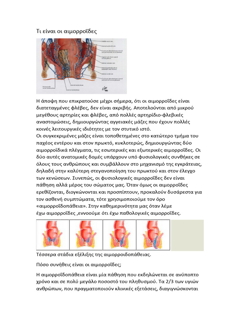 Αιμορροΐδες τι είναι | PDF