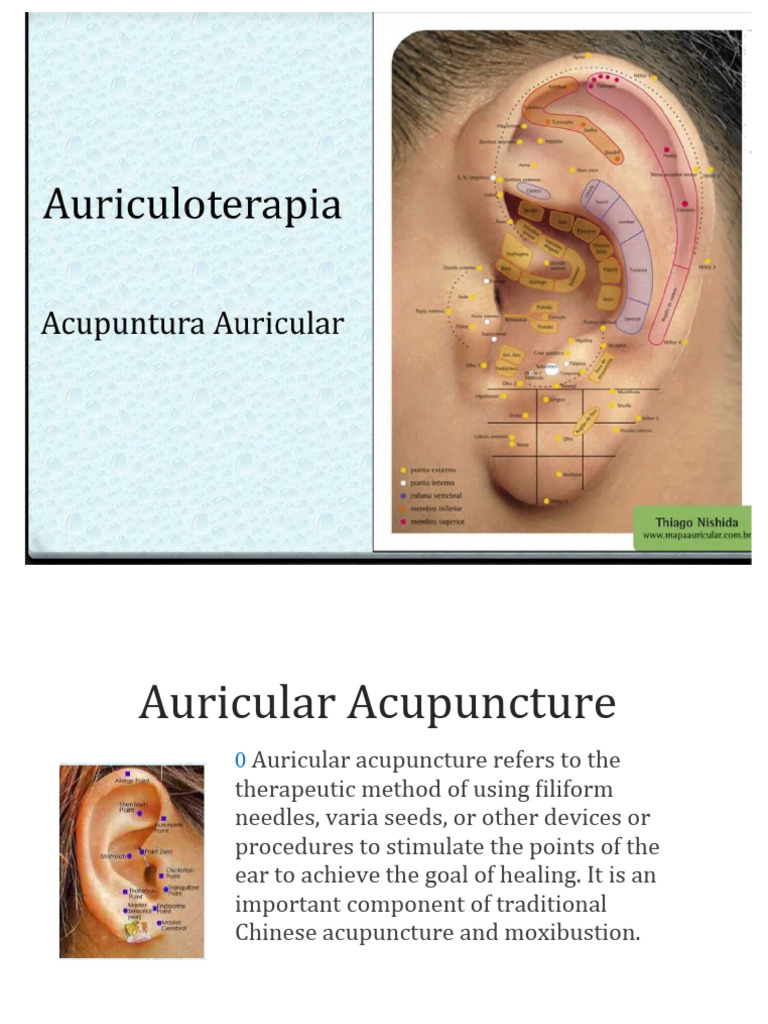 Auriculotherapy Presentation DF | PDF | Acupuncture | Abdomen