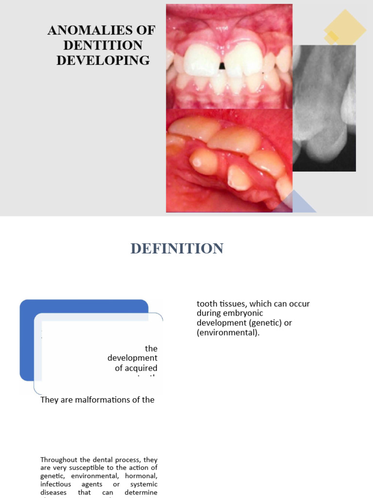 15 Anomalies of The Developing Dentition | PDF | Human Tooth | Tooth Enamel