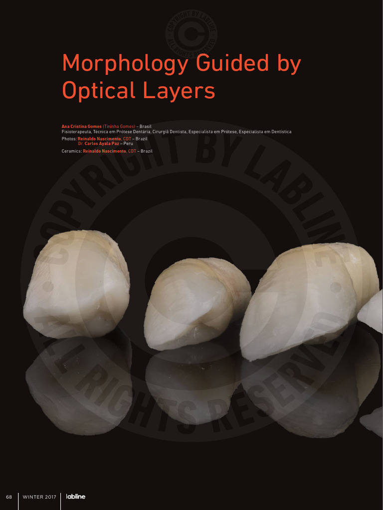 Morfologia Guiada Pelas Camadas Ã Pticas Labline | PDF | Tooth Enamel | Tooth