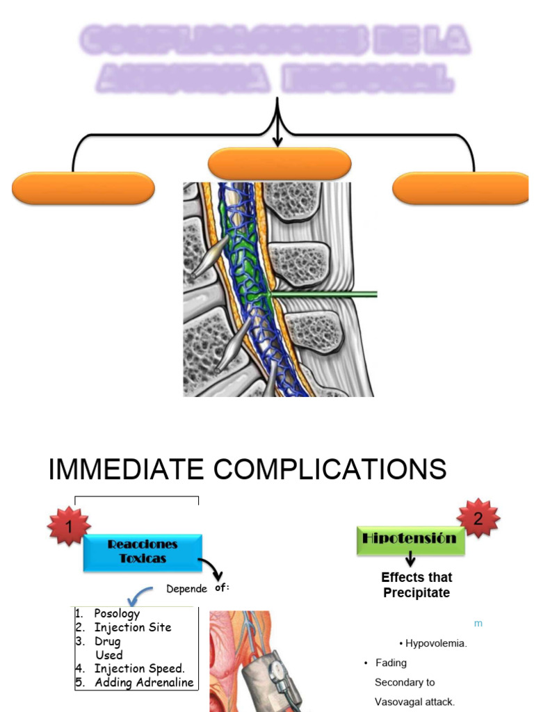 Complications of Regional Anesthesia | PDF | Anesthesia | Nervous System