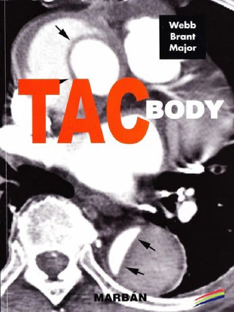 TAC BODY Ultima | PDF | Ct Scan | Abdomen
