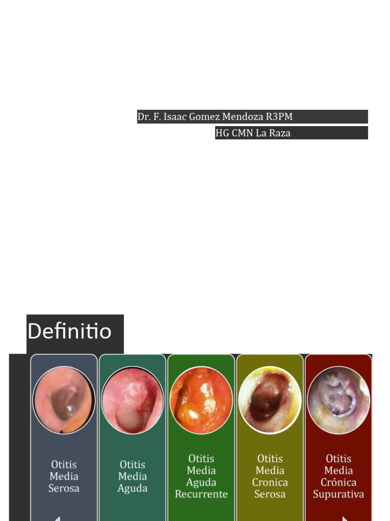 Comprehensive Overview of Otitis Media Definitions, Classifications ...