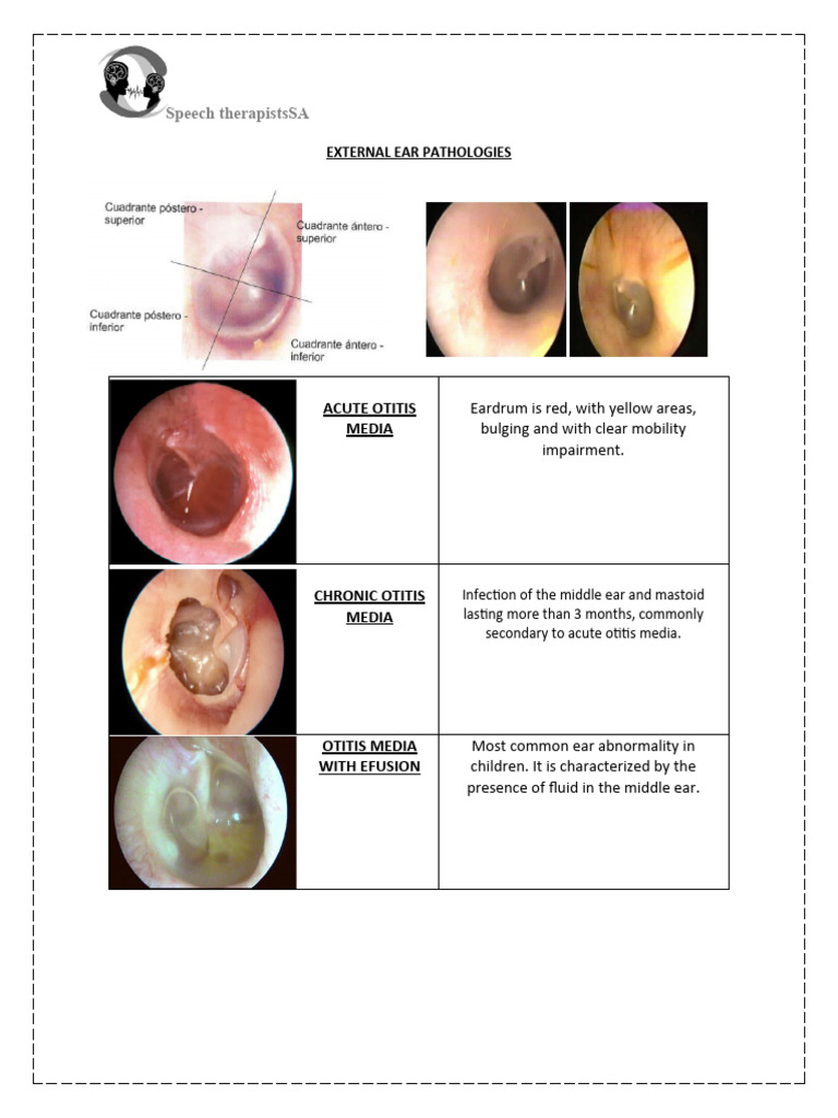 External Ear Pathologies | PDF | Ear | Hearing