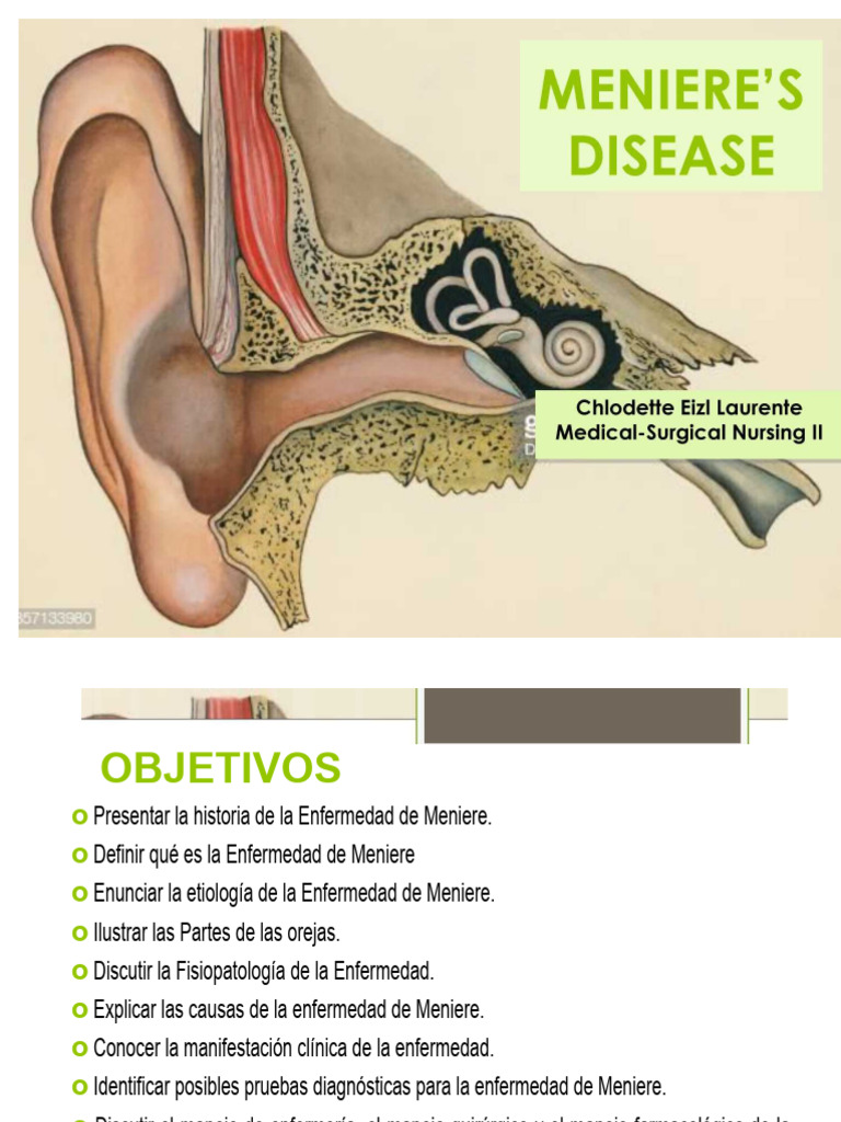 La Enfermedad de Meniere | PDF | La enfermedad de Meniere | Oído
