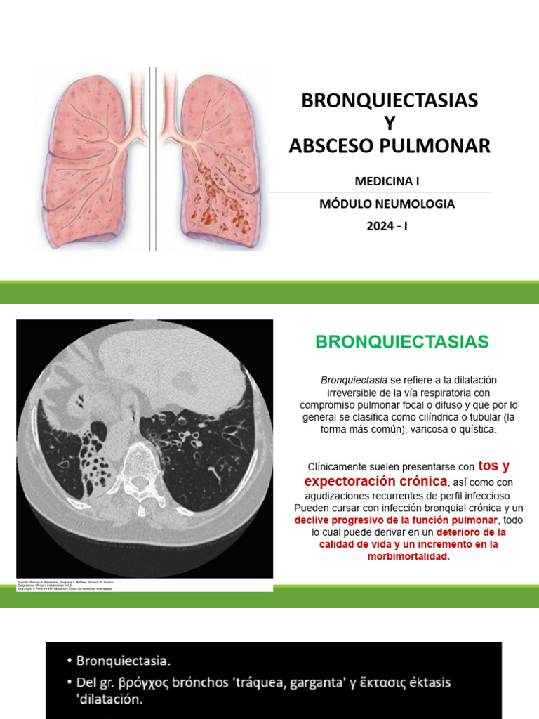 Sesión 4 Bronquiectasias y Absceso Pulmonar | PDF | Tos | Medicina