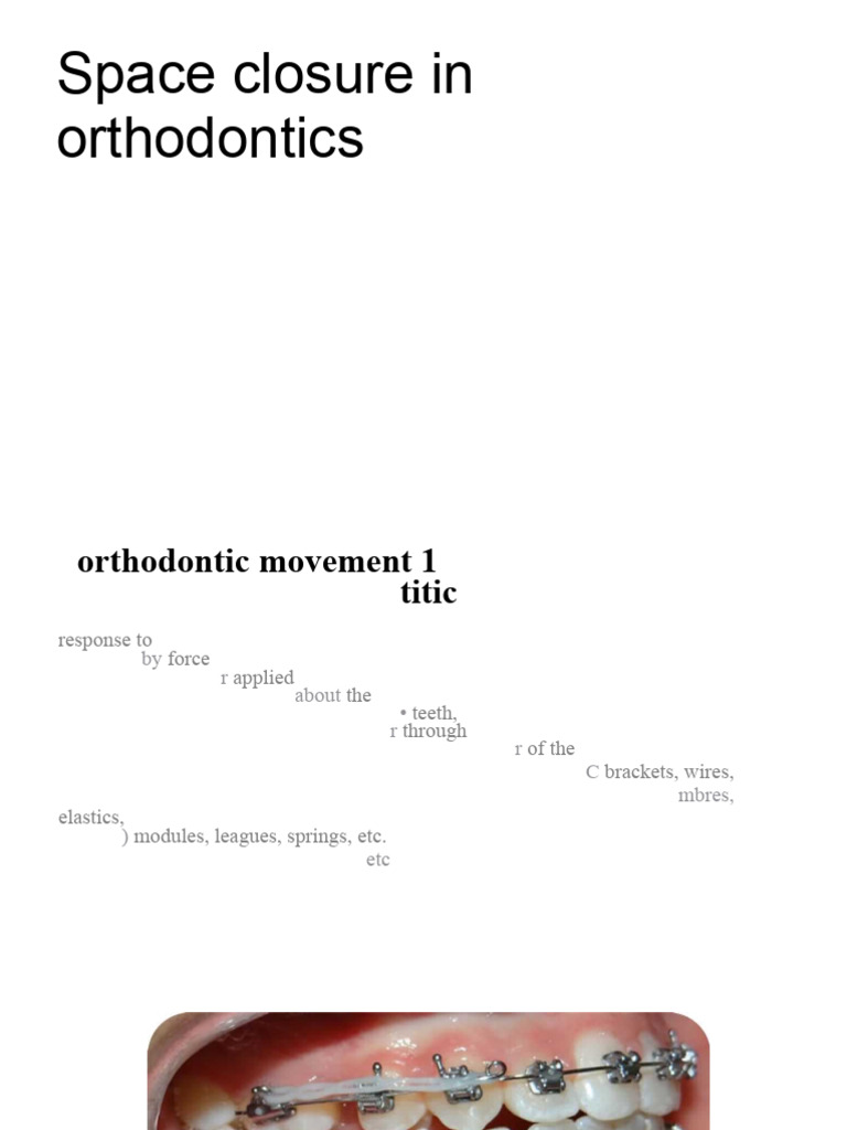 Orthodontic Space Closure Techniques | PDF | Human Tooth | Orthodontics