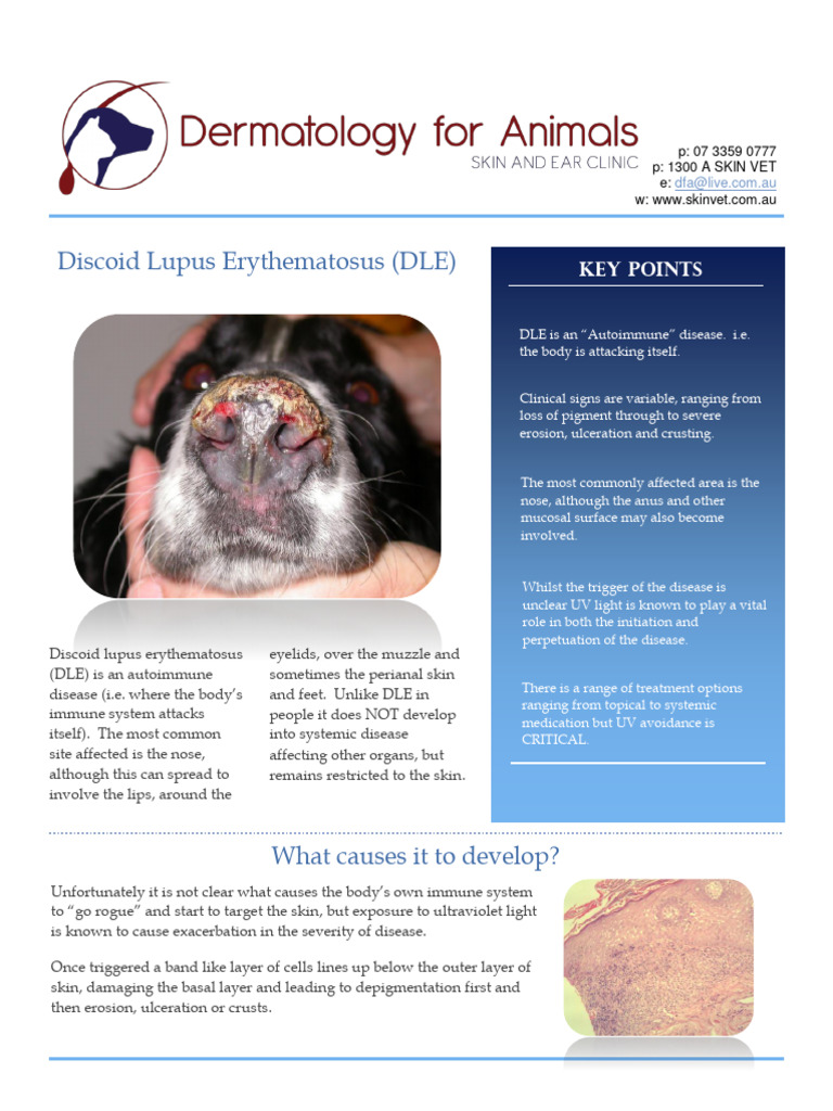 Discoid Lupus Erythematosus (DLE) : Key Points | PDF | Skin | Human ...