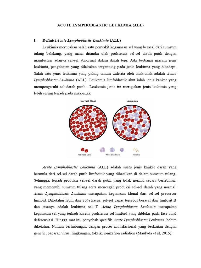 Acute Lymphoblastic Leukemia | PDF