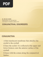 Lid Parallel Conjunctival Folds (LIPCOF) | PDF | Optics | Ophthalmology