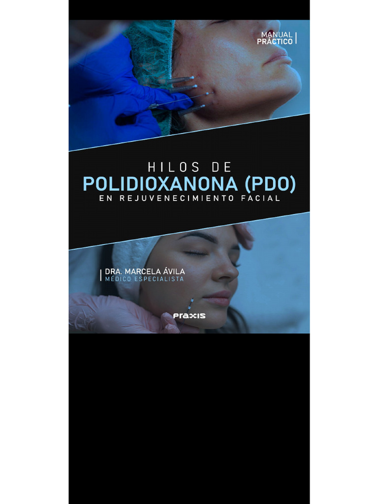 Hilos Pdo | PDF