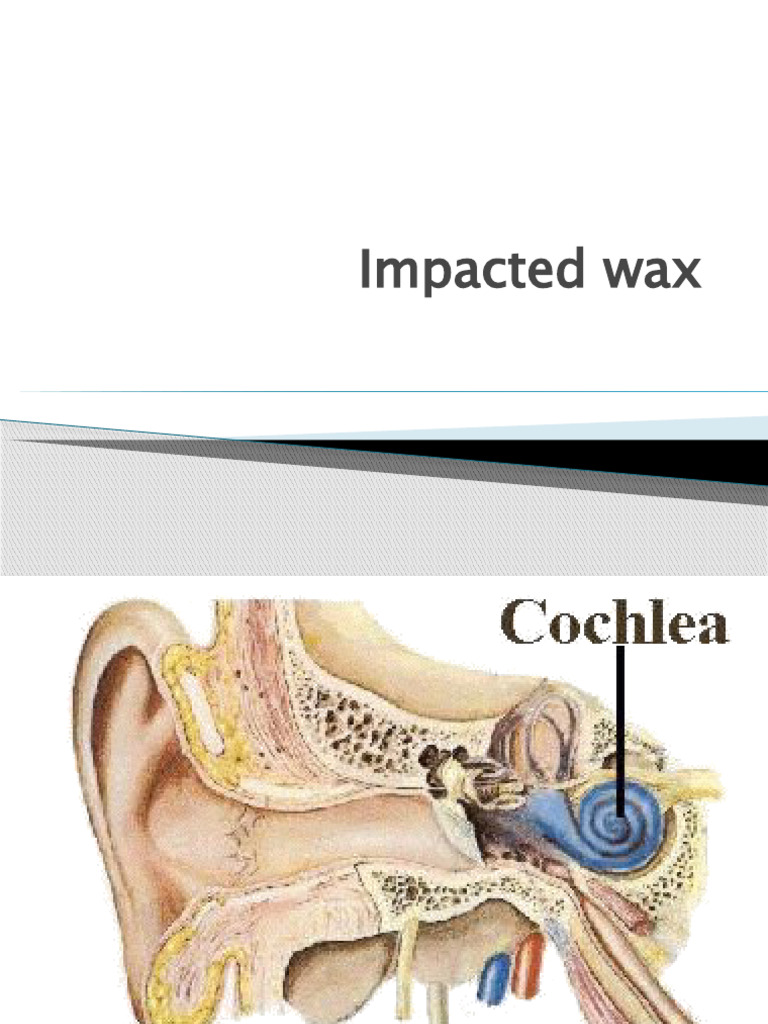 Impacted Wax | PDF