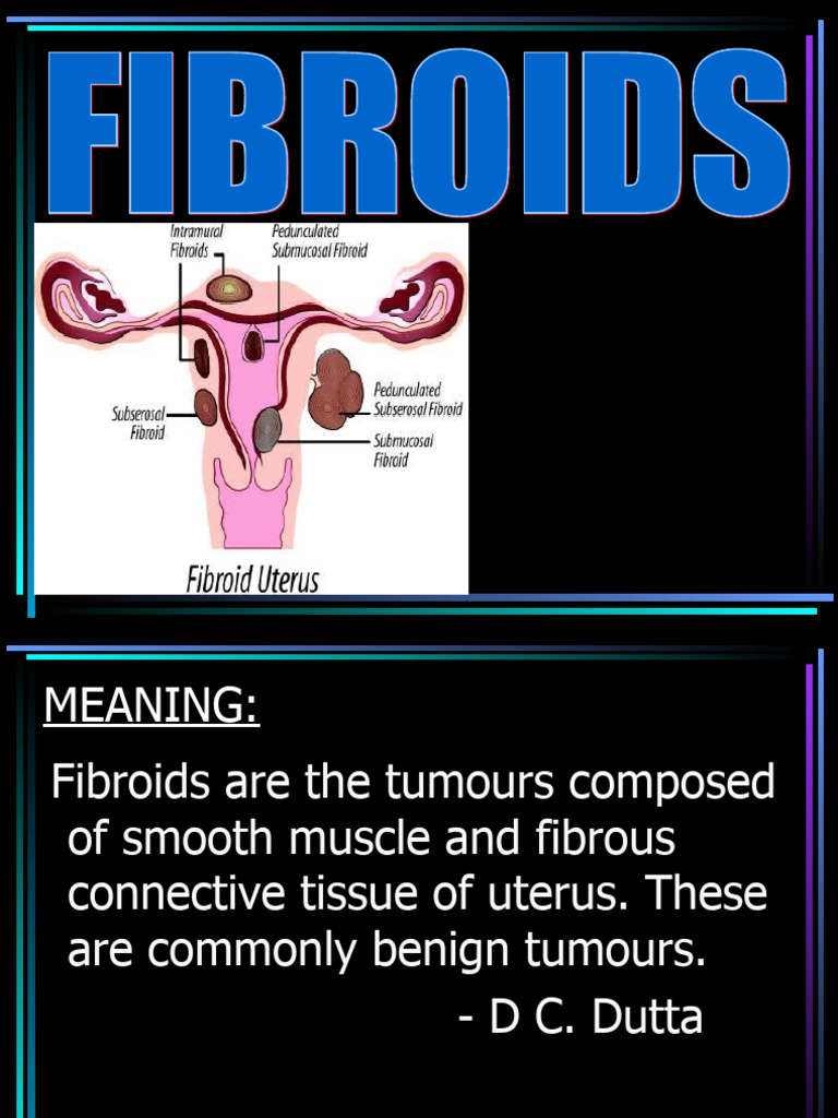 Fibroids | PDF | Uterus | Childbirth