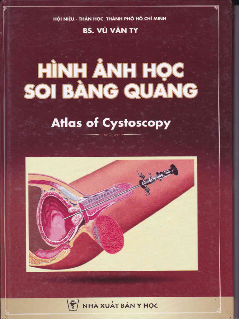 Hình Ảnh Học Soi Bàng Quang | PDF