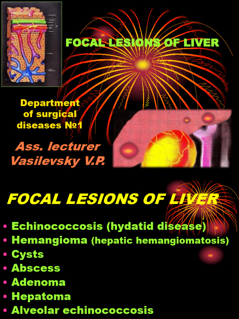 Focal Lession of Liver | PDF | Liver | Medical Imaging
