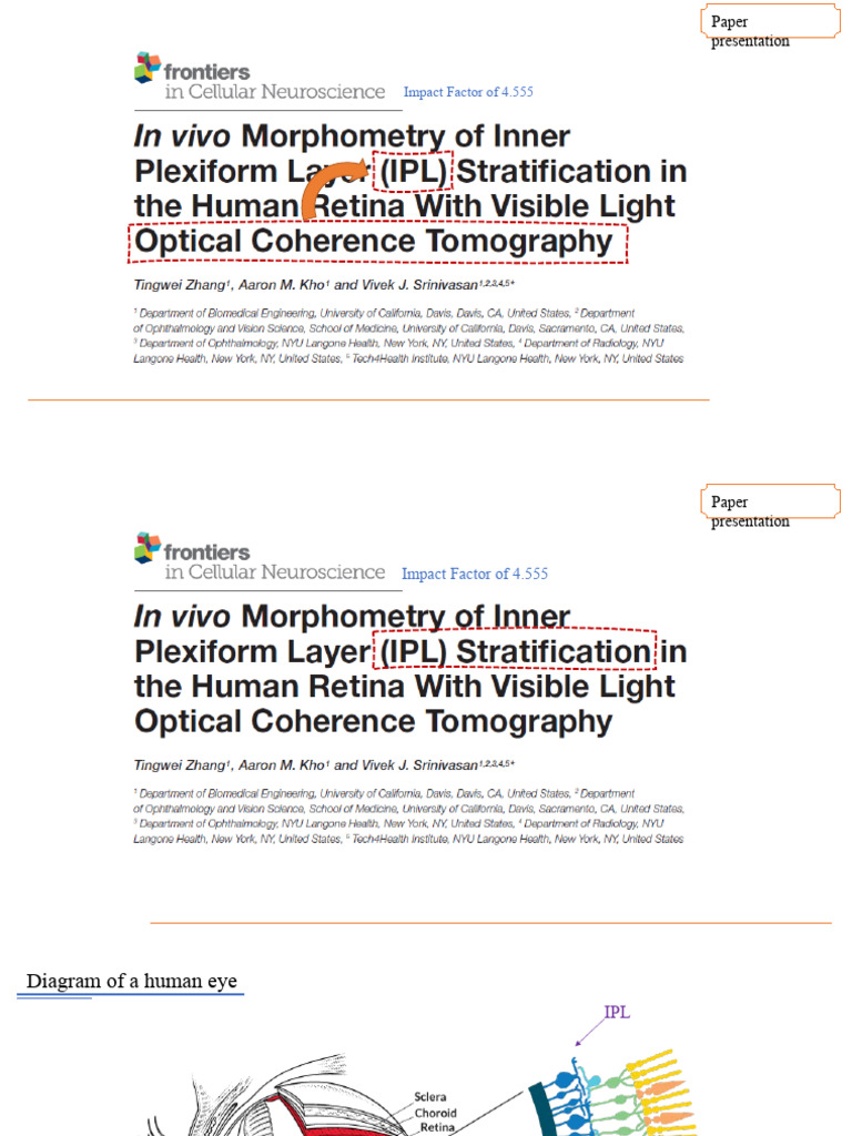 This Is A Paper Summary For A Retina IPL Sublayerstudy | PDF | Retina ...