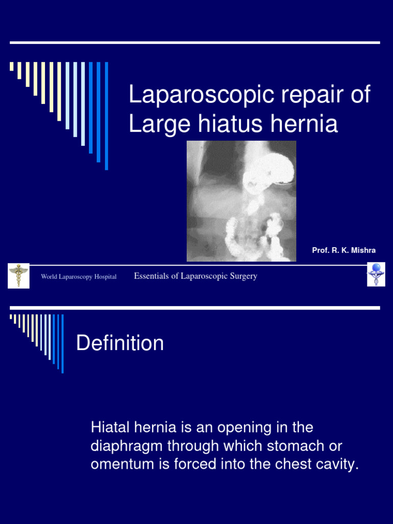 Laparoscopic Repair of Hiatus Hernia | PDF | Medical Specialties ...