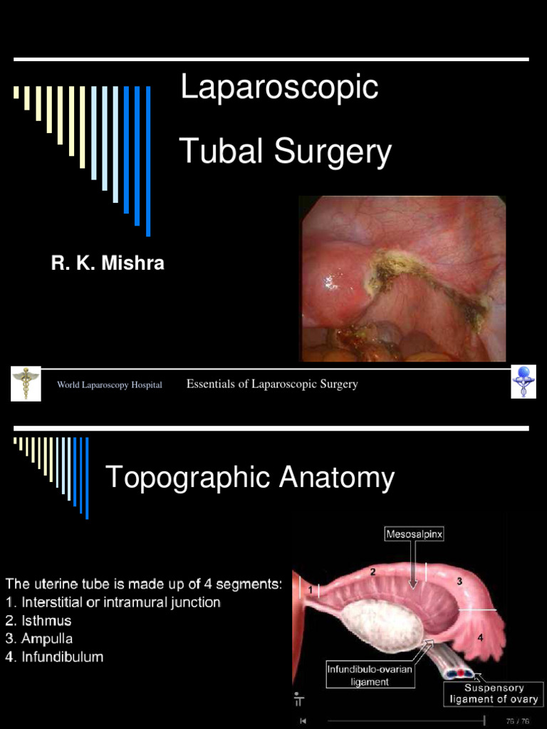 Laparoscopic Salpingo Oophorectomy | PDF | Surgery | Surgical Specialties