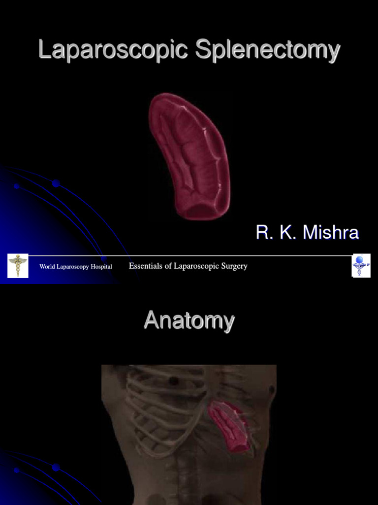 Laparoscopic Splenectomy | PDF | Surgery | Spleen