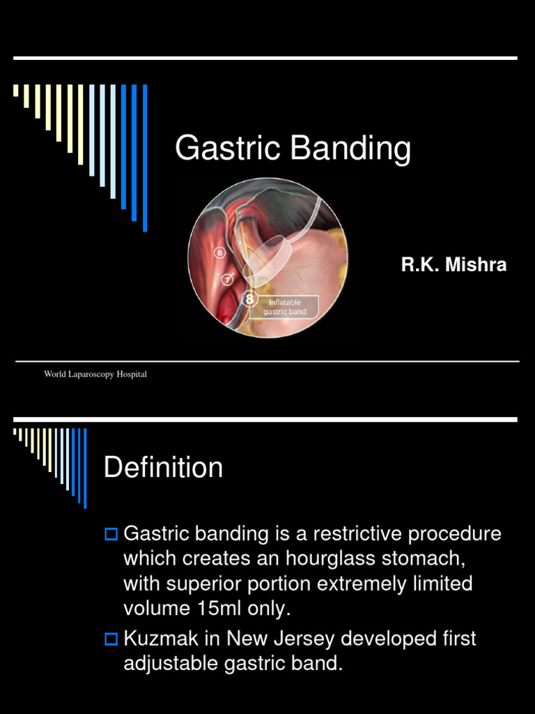 Laparoscopic Gastric Banding | PDF | Medical Specialties | Clinical ...