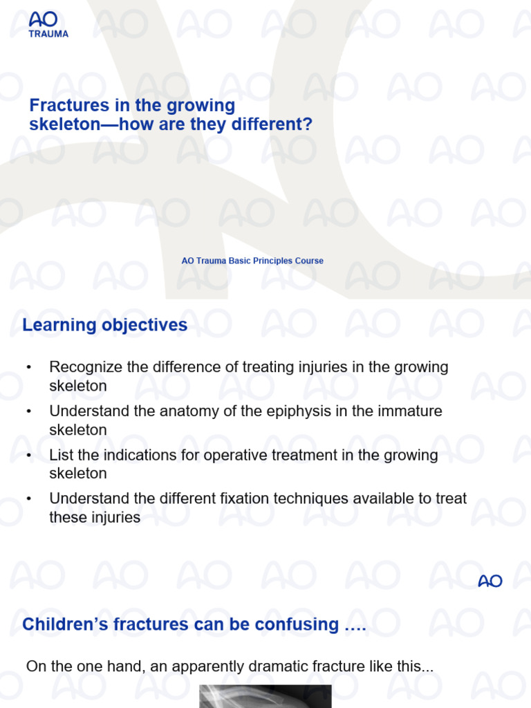 7.5 Fractures in The Growing Skeleton | PDF | Musculoskeletal Disorders ...