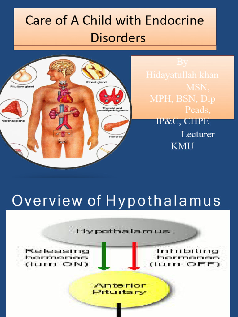Unit 20 Endocrine Dysfunctions in Pediatric Clients, Educational ... Unit 20 Endocrine Dysfunctions in Pediatric Clients, Educational ...