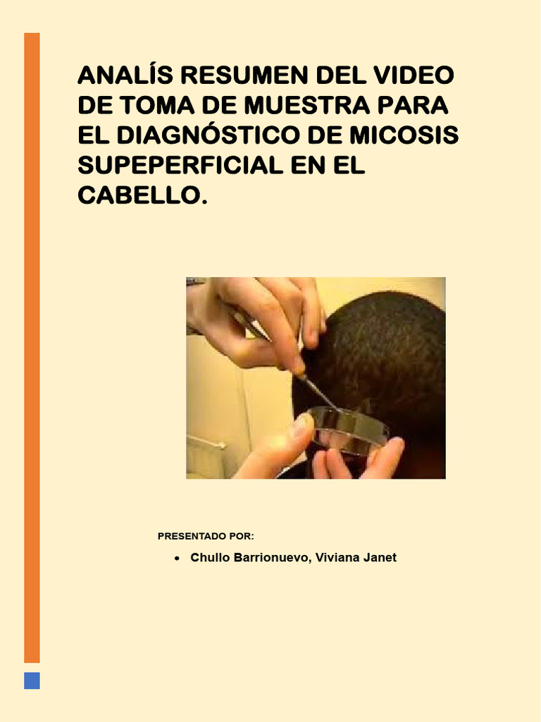 Analís Resumen Del Video de Toma de Muestra para El Diagnóstico de Micosis Supeperficial en El ...