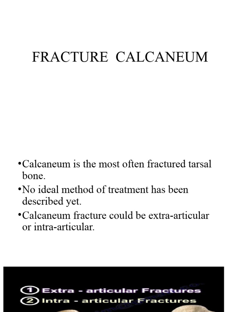 Fracture Calcaneum 1 | PDF | Musculoskeletal System | Musculoskeletal ...