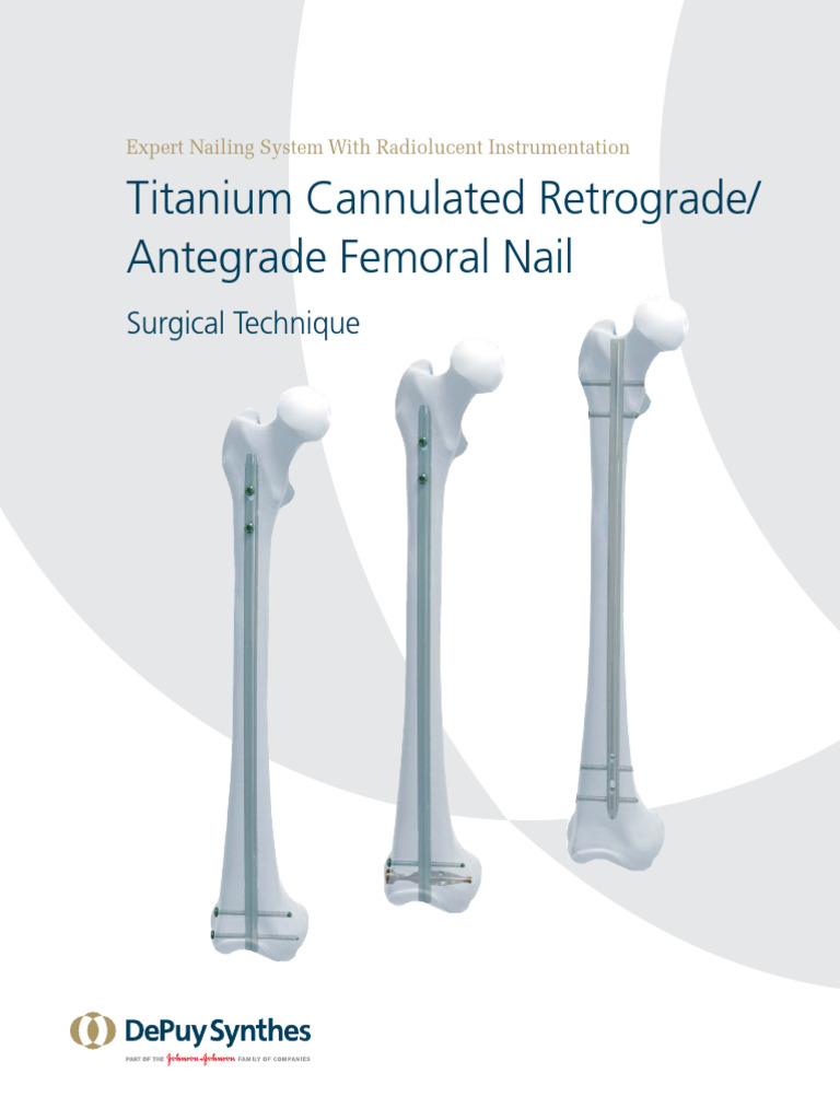 Retrograde Antegrade Femoral Nail Surgical Technique Guide | PDF ...