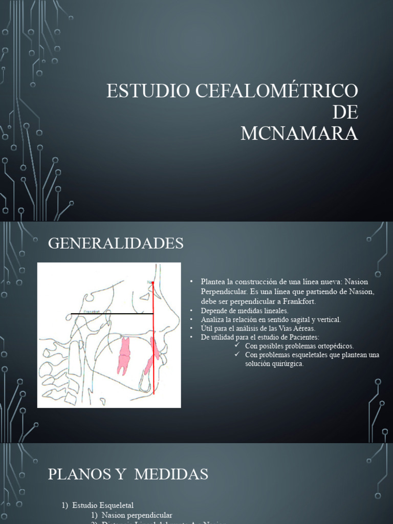 Estudio Cefalométrico de McNamara | PDF | Cabeza y cuello humanos | Anatomía humana